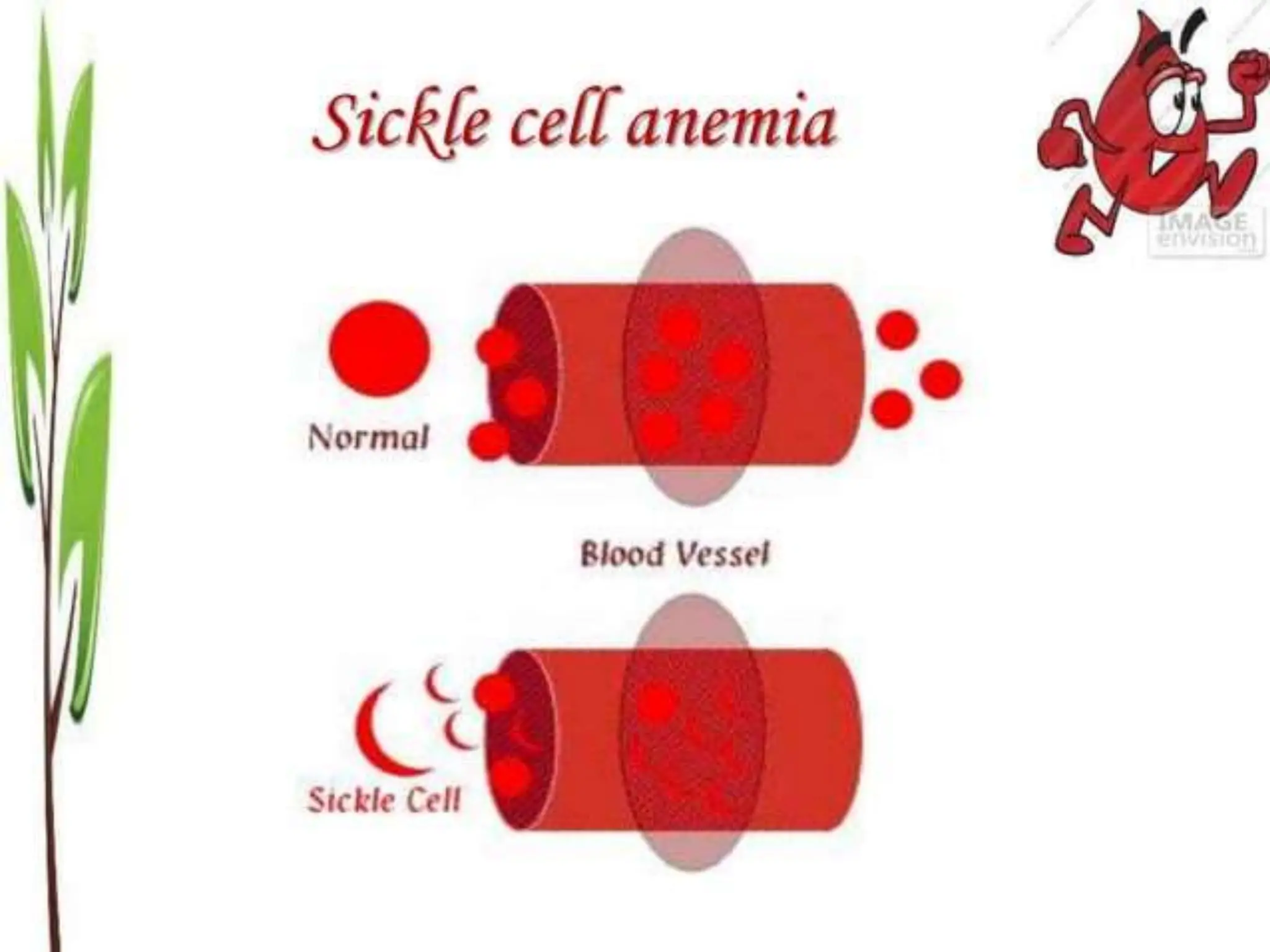 ANEMIA.pptx anemia notes for nursing students | PPTX
