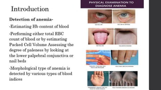 Presentation on Anaemia decreasing in Hb.pptx