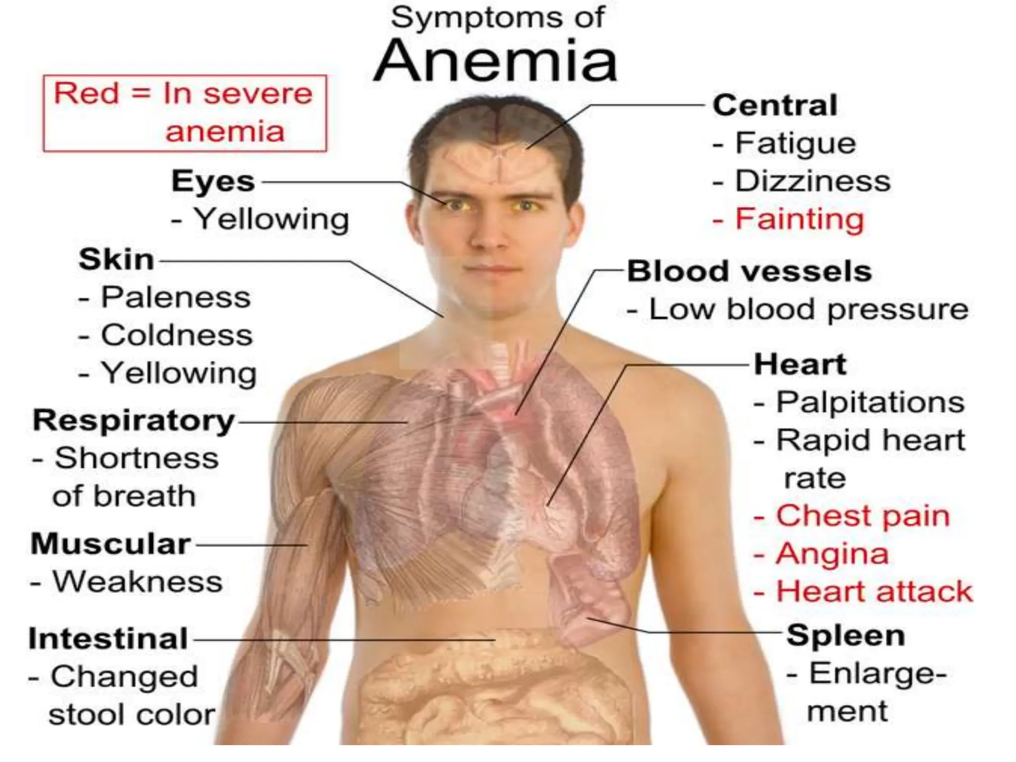 disease condition seen in adolescent girl " ANEMIA" | PPT