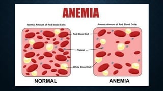 Types of anemia and its cure with diet chart | PPTX