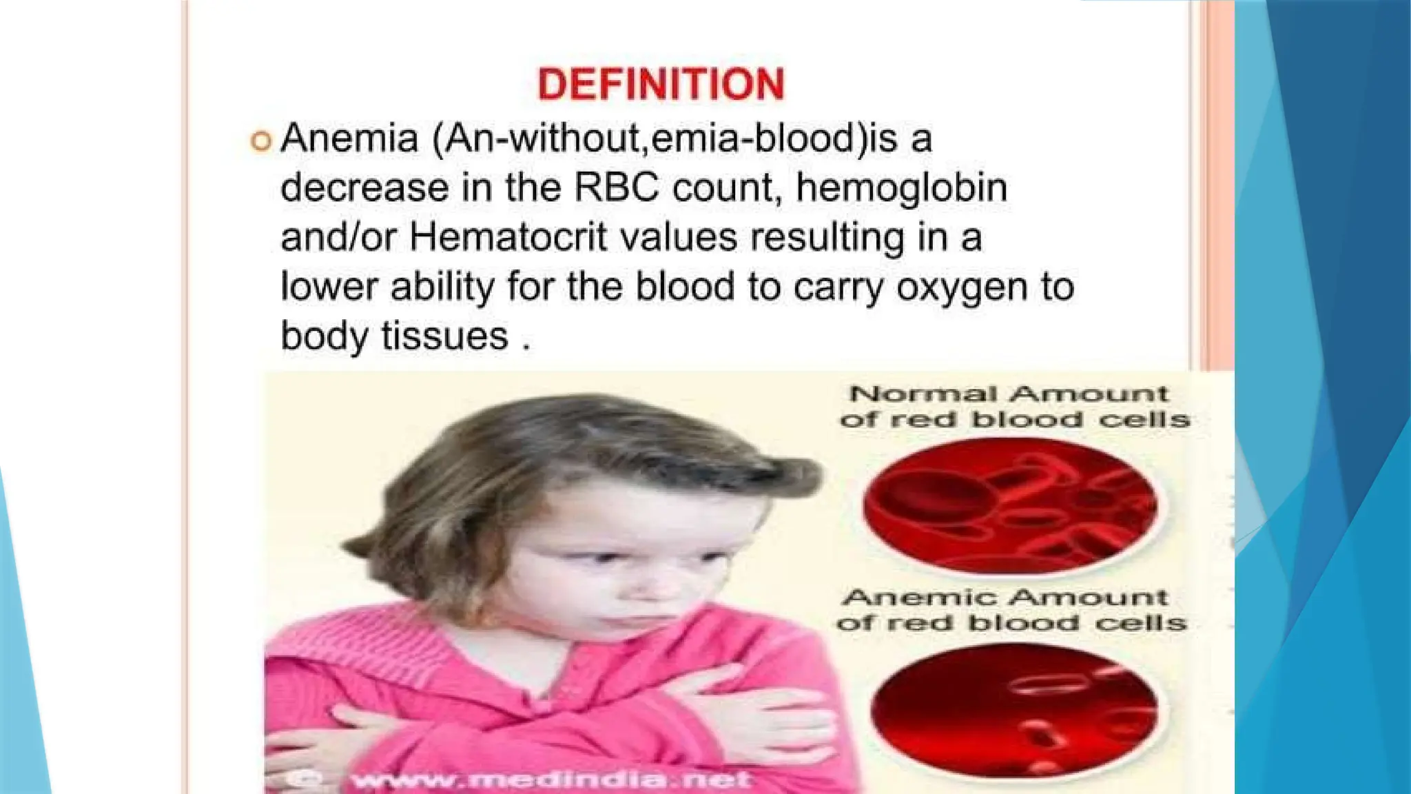 Management of iron deficiency anemia in women | PPTX