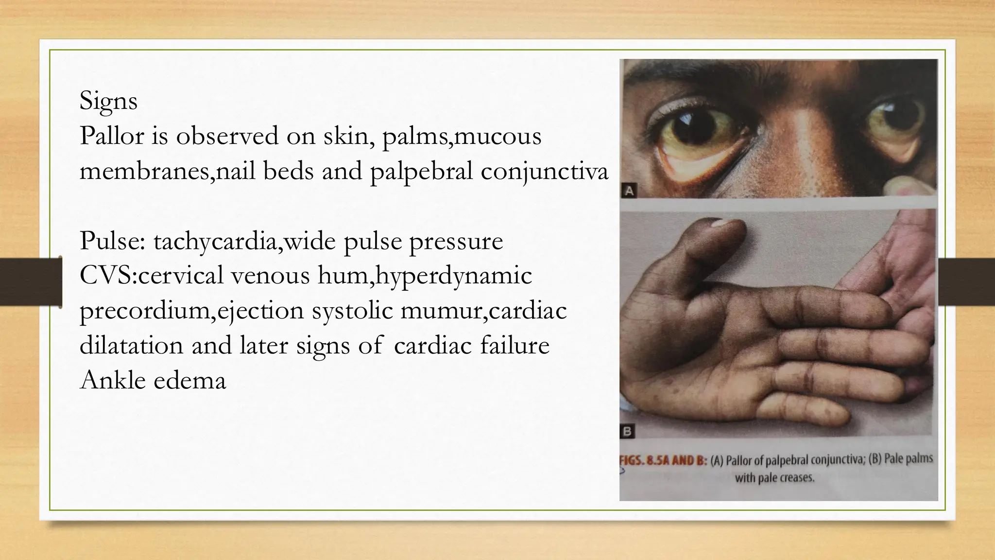 Anemia classification and clinical features | PPT