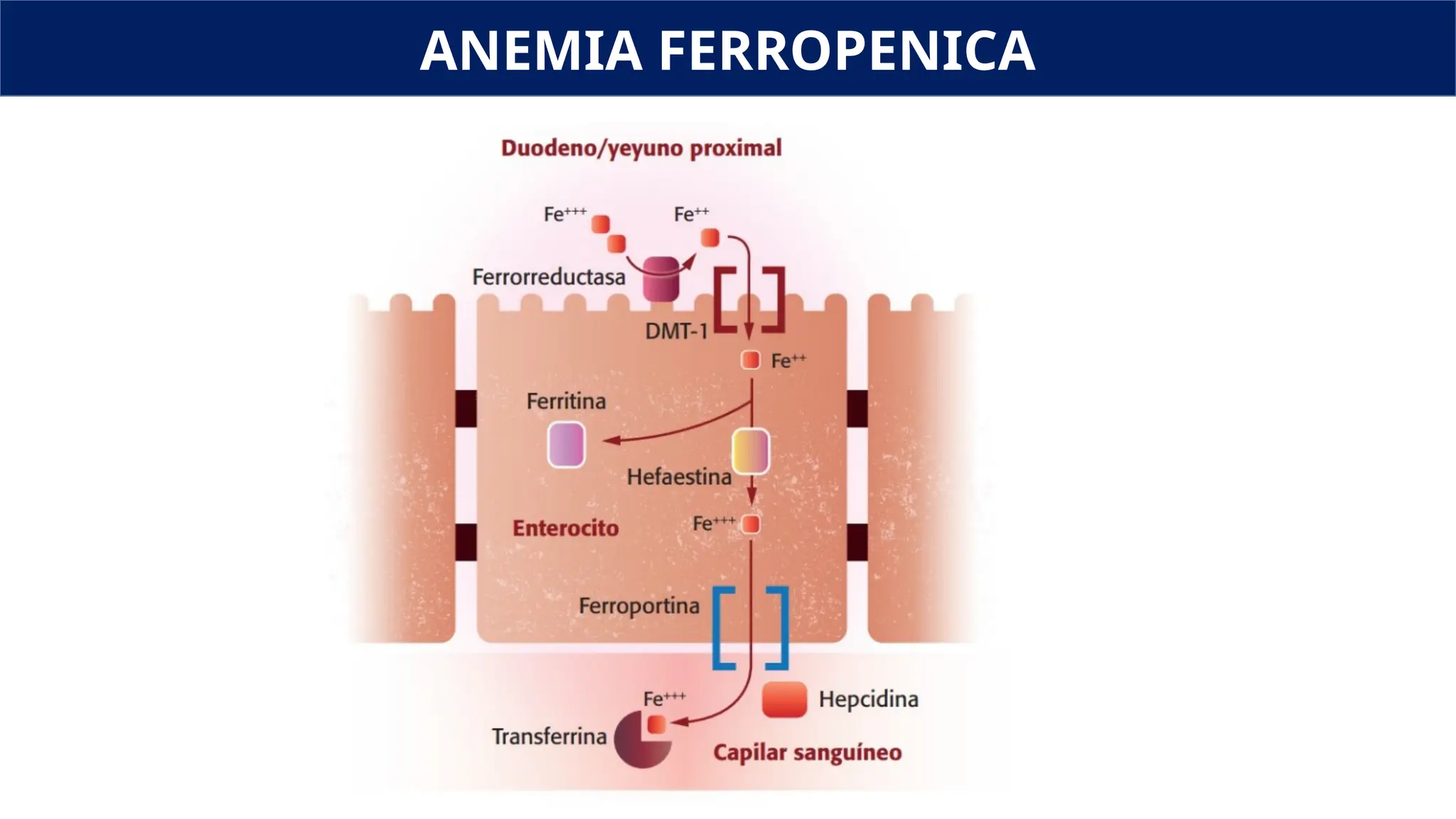 ANEMIA ferropenica, definicion, clasificacion, fisiopatologia | PPTX