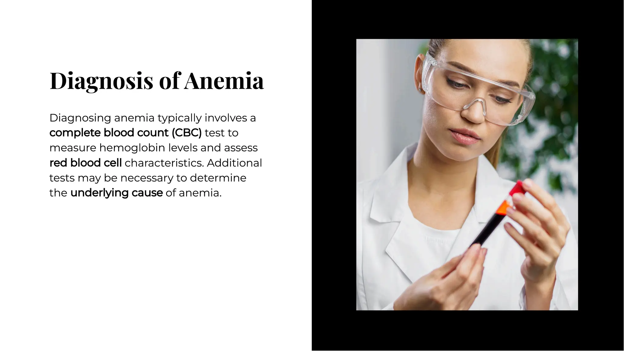 Anemia and it's types and management.pdf