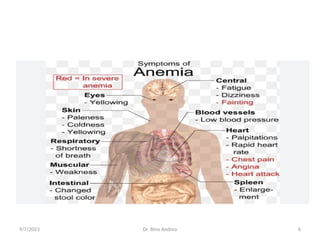 Anemia.pptx_4th_year pathology lecture ppt | PPT