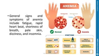 iron deficiency Anemia and treatment .pdf