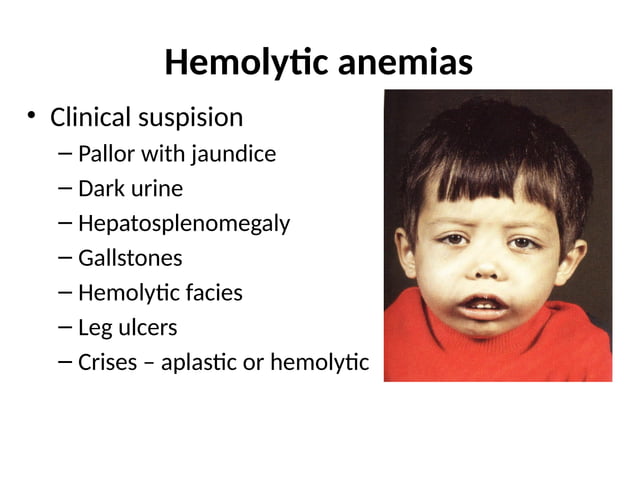 Anemia classification, basic lab diagnosis.pptx