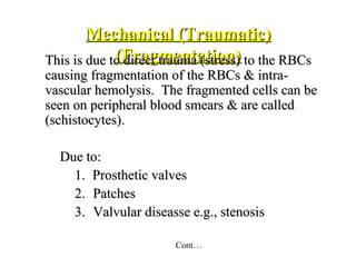 Anemia And Its Classification | PPT