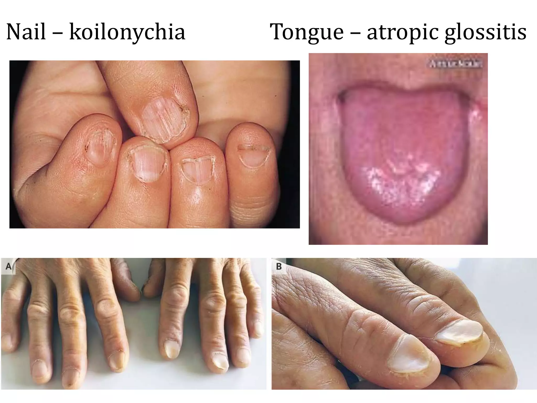 Anemia classification, cf, lab diagnosis | PPT