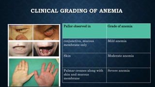 Anemia | PPT