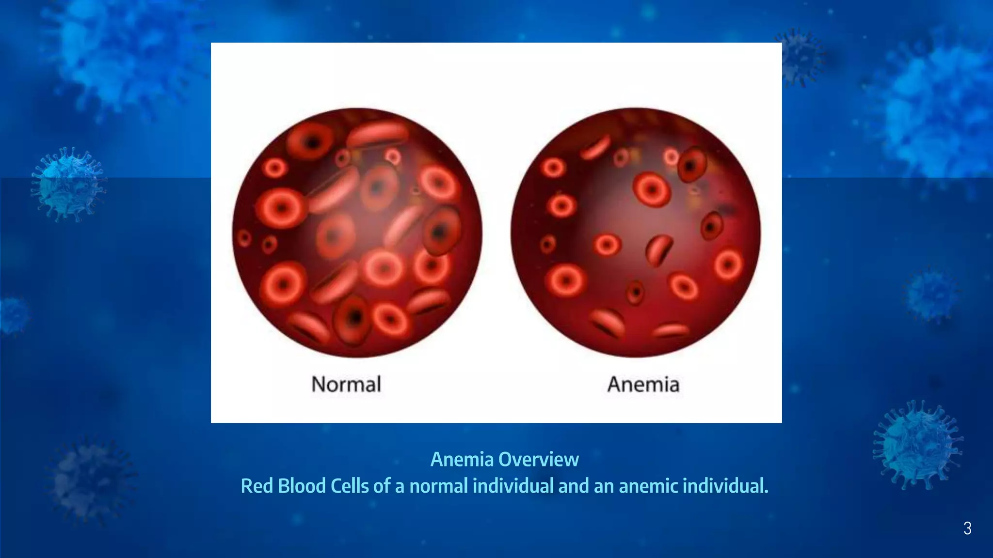 Anemia diagnosis & treatment | PPTX