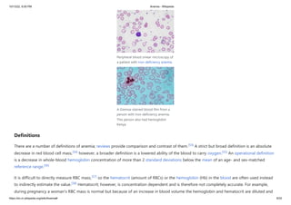 Anemia - Wikipedia.pdf