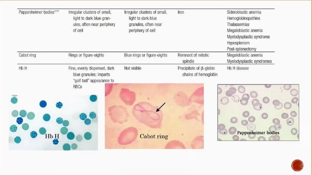 Approach to Anemia - Internal Medicine | PDF | Medical Health