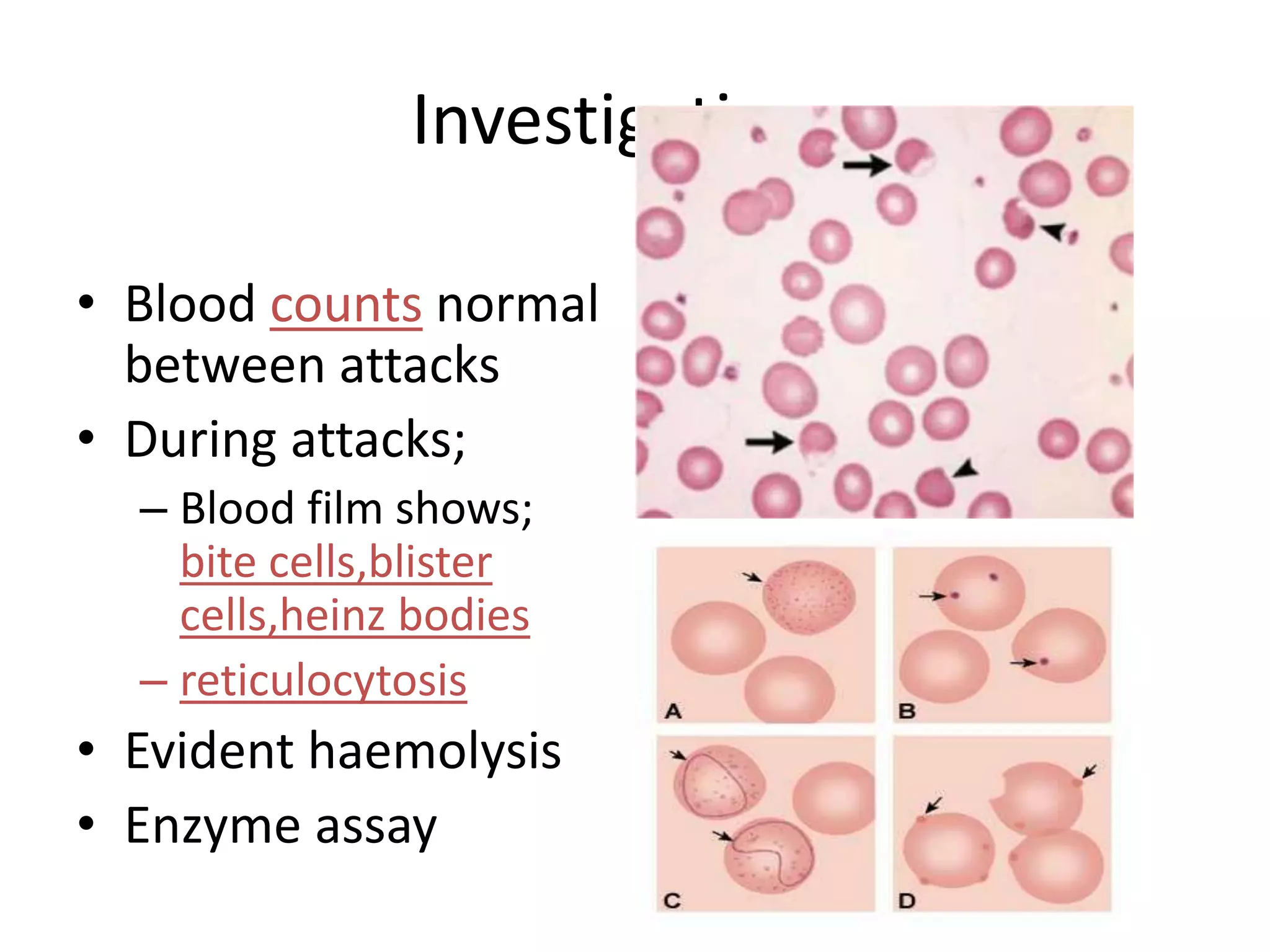 Anemia Presentation | PPTX