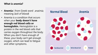 Anemia 2.0.pptx