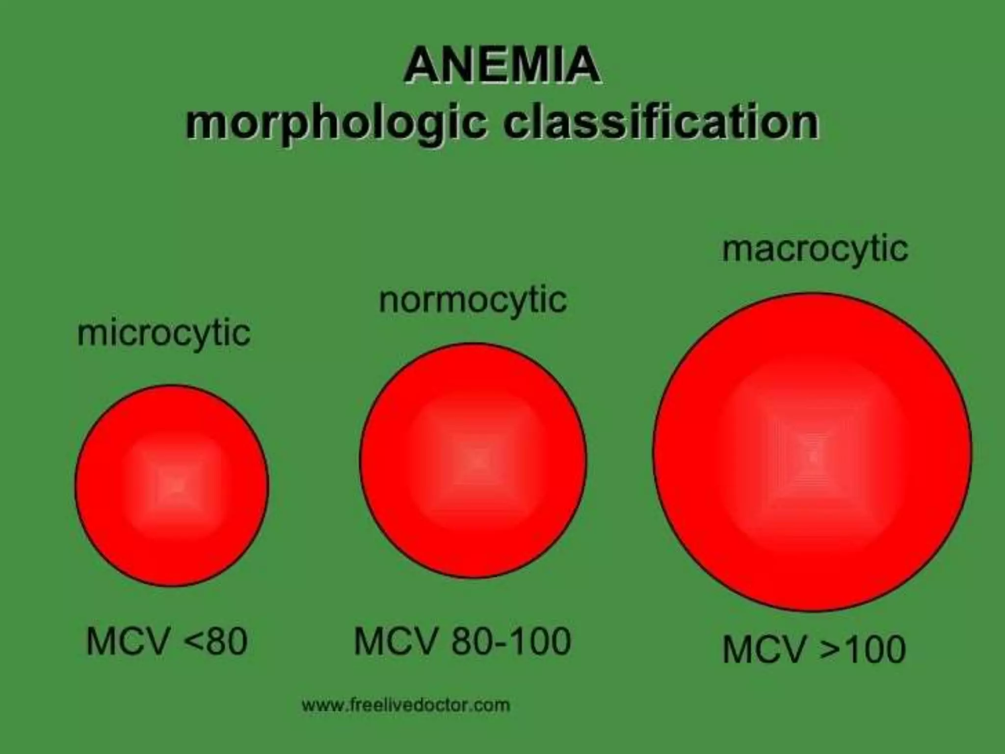 Anemia and its classification | PPTX