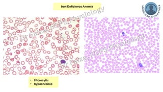 Anaemia & Polycythaemia Physiological Basis | PDF
