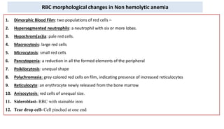 Anemia Classification and Investigation Tests.pdf