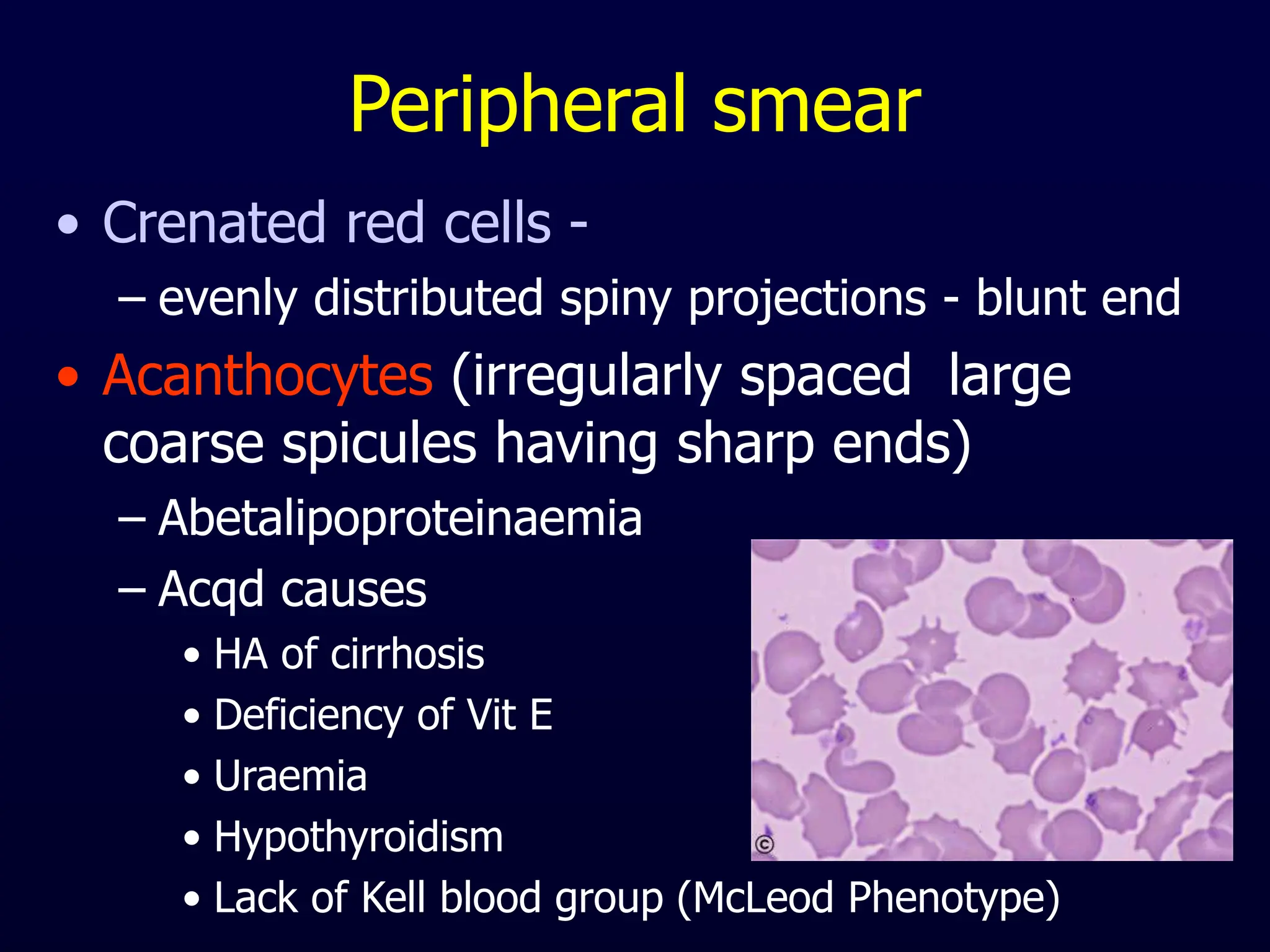 Anemia classification & pathogenesis.ppt