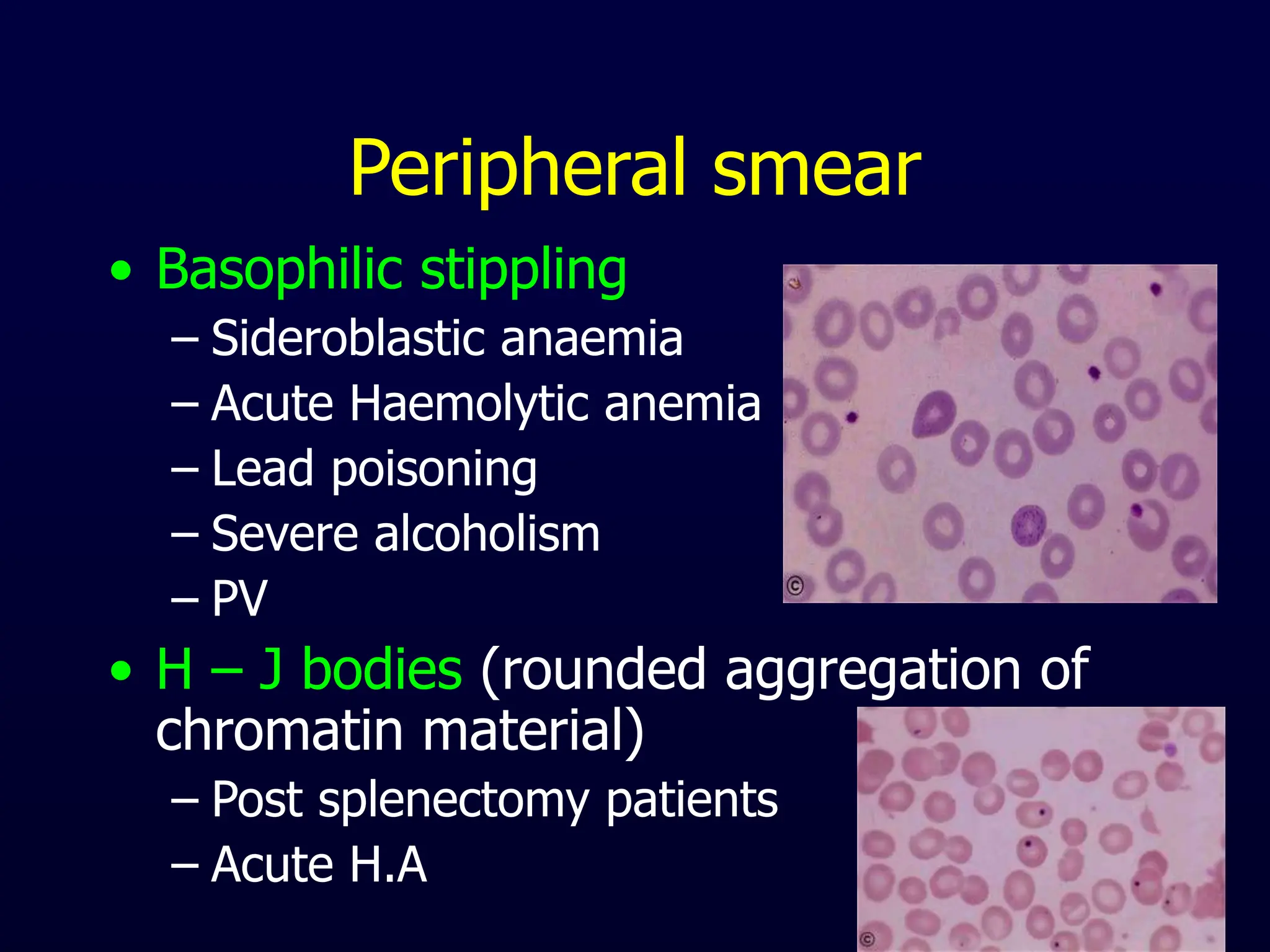 Anemia classification & pathogenesis.ppt