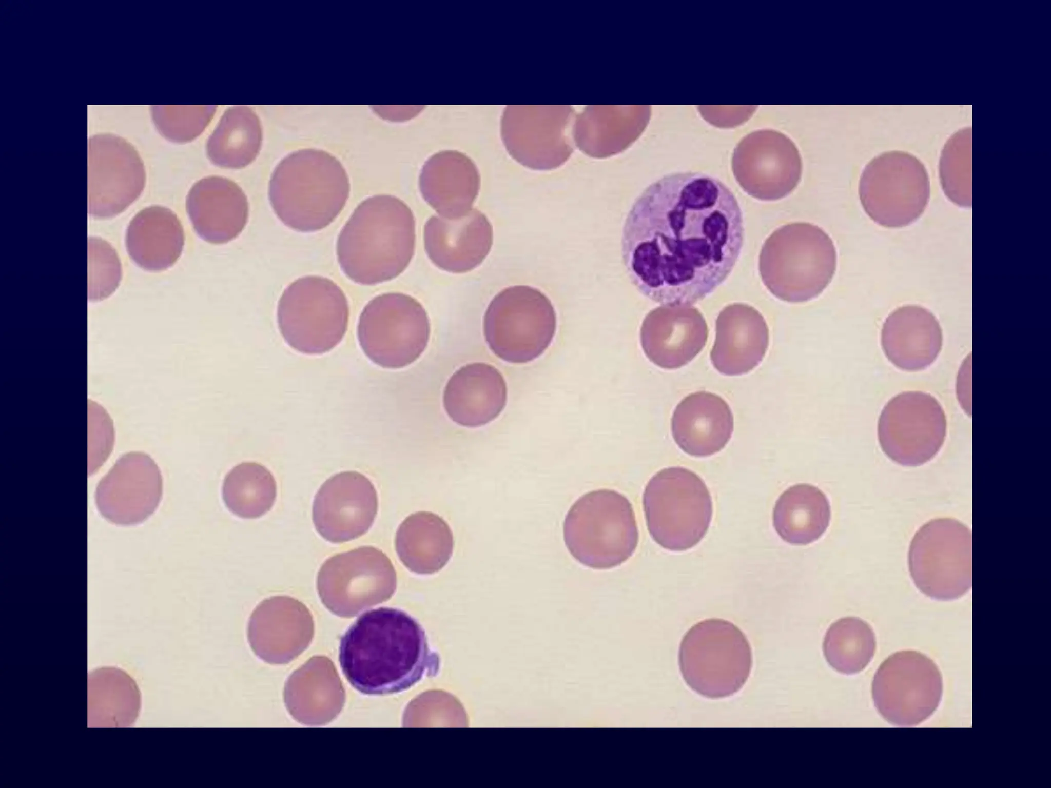 Anemia classification & pathogenesis.ppt