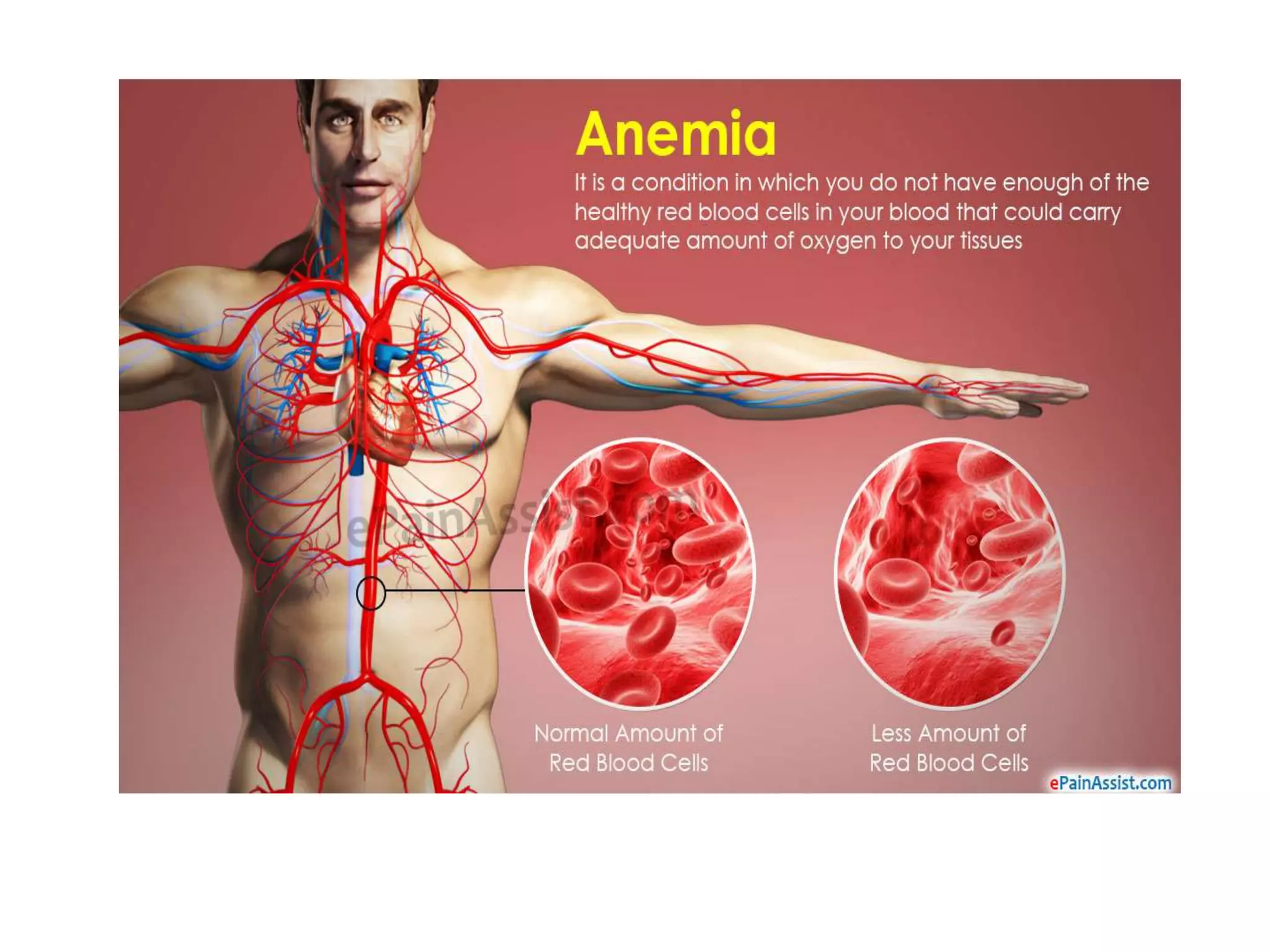 ANEMIA CONTROL PROGRMME PPT FOR CLASS.pptx