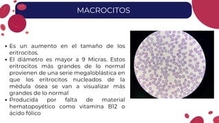Anemia cronica y macrocitica (fisiopatologías) | PPT