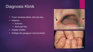 Anemia Defisiensi Besisssssssssssss.pptx