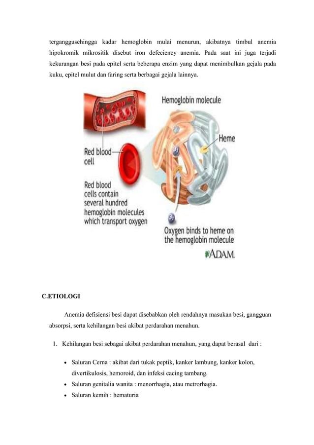 Anemia defisiensi besi | PDF