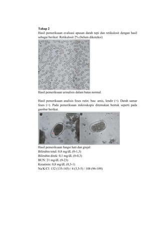 ANEMIA DEFISIENSI BESI EC PERDARAHAN KRONIK EC INFESTASI HOOKWORM ...
