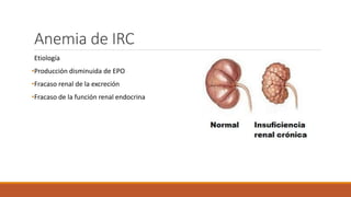 Anemia de los padecimientos no hematológicos | PPTX