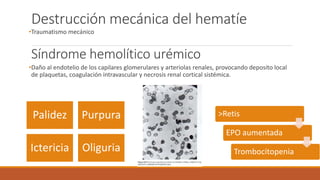 Anemia de los padecimientos no hematológicos | PPTX