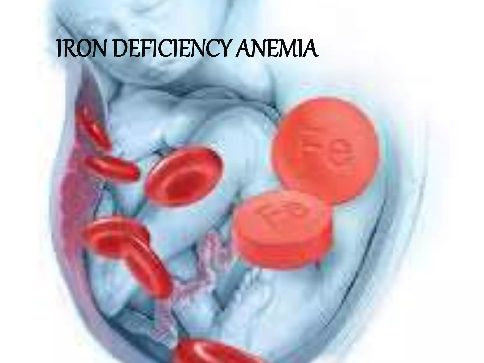 Anemia during pregnancy/types/causes/prevention and management | PPTX