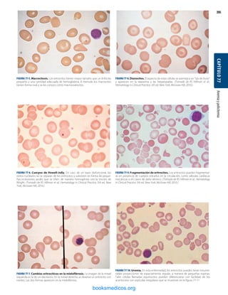 Anemia en general valores noirmales harrison | PDF