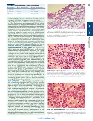 Anemia en general valores noirmales harrison | PDF