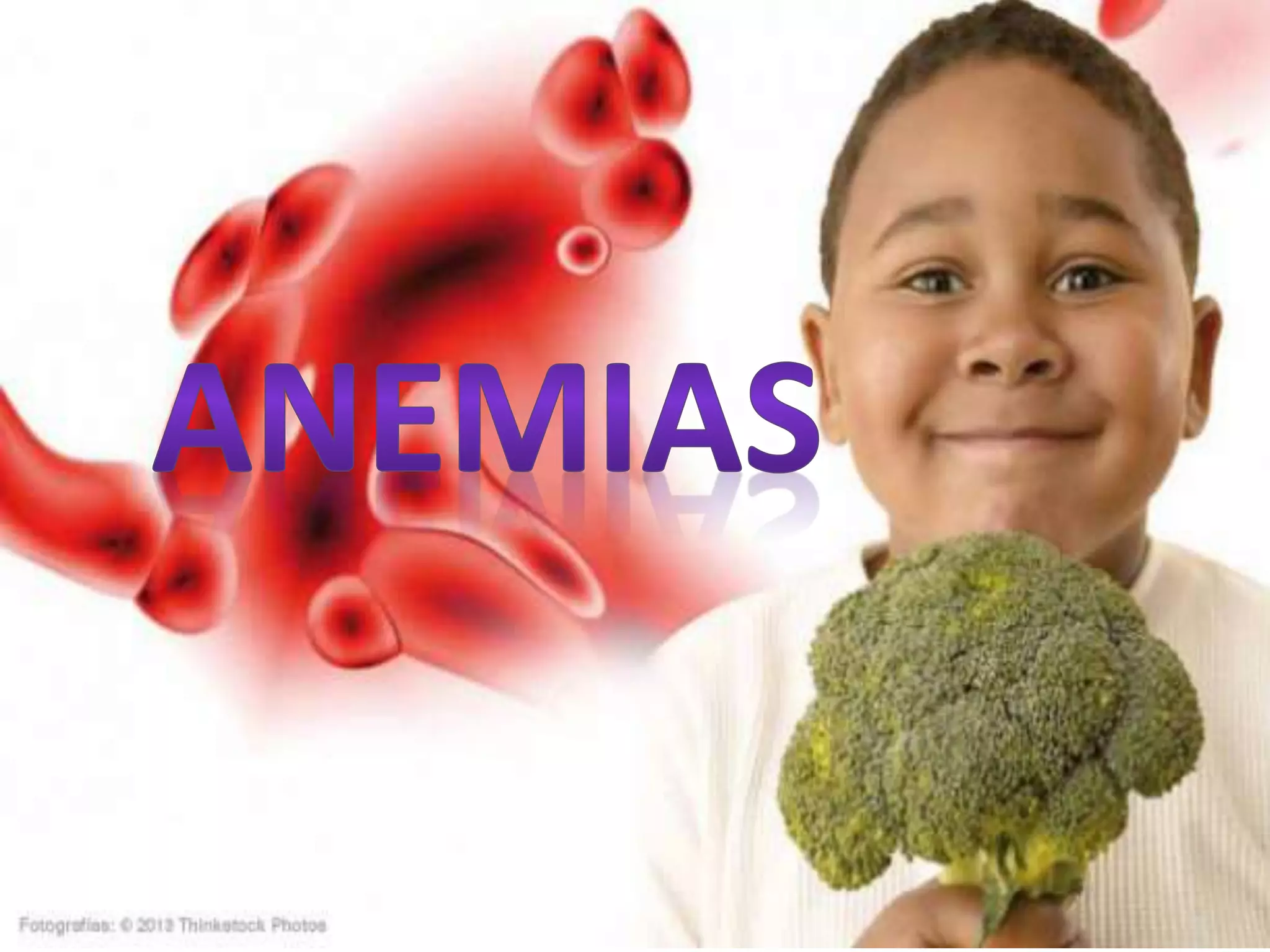 anemia en niños.pptx
