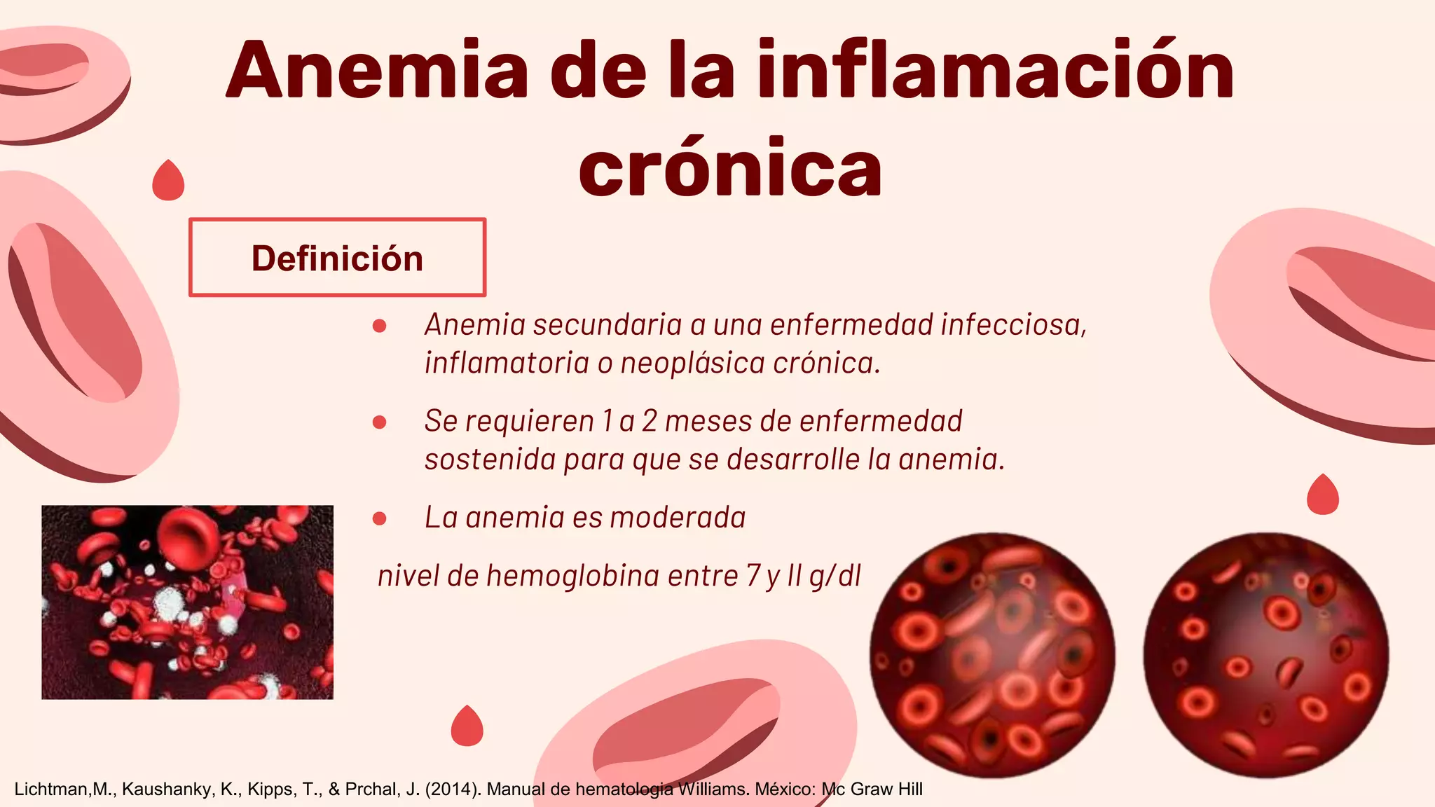 Anemia en paciente con cancer y anemia de la inflamacion cronica.pptx