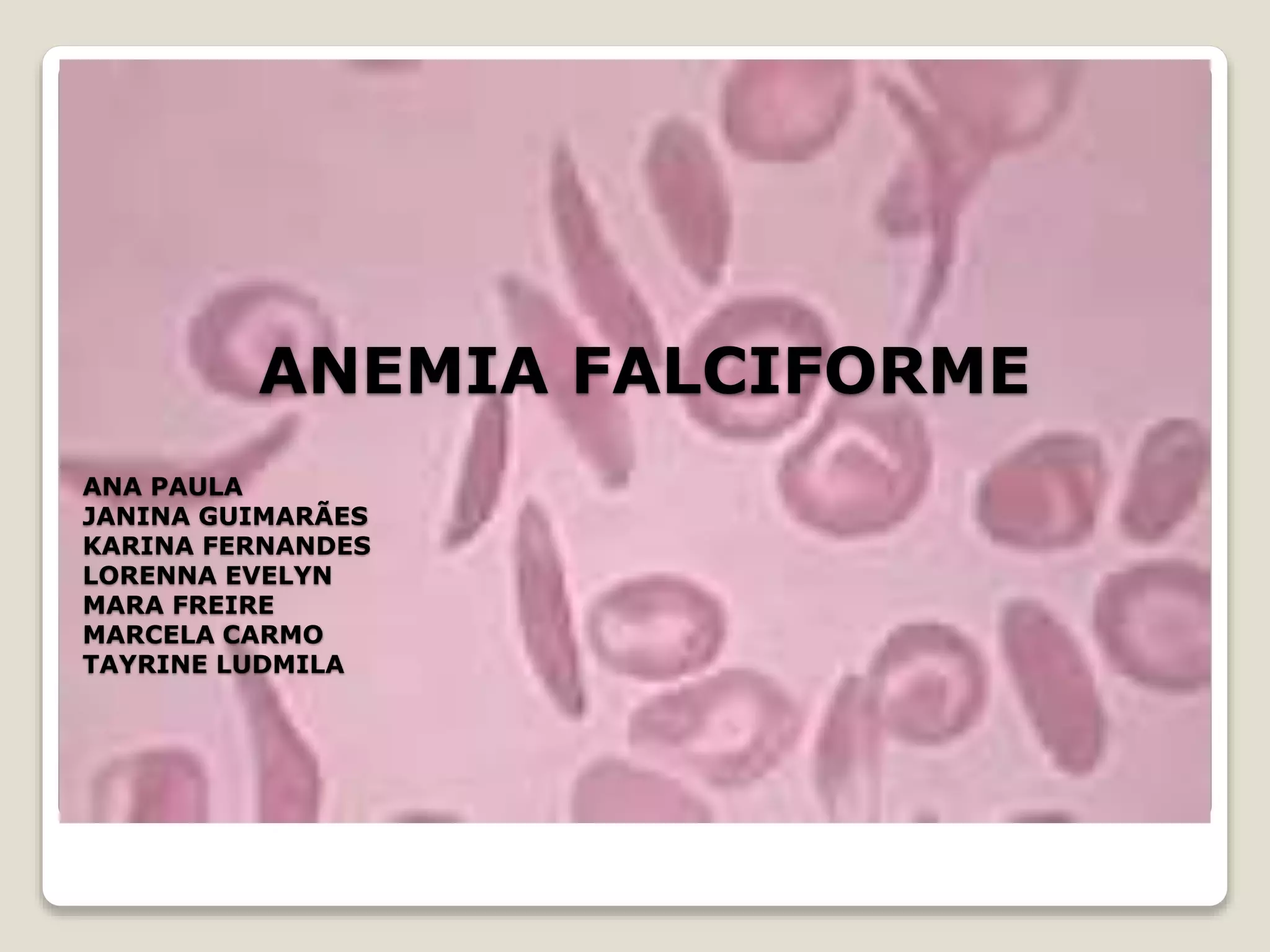 Anemia falciforme | PPT