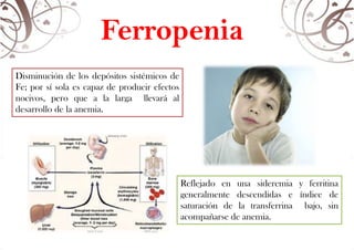 Anemia Ferropenica | PPTX