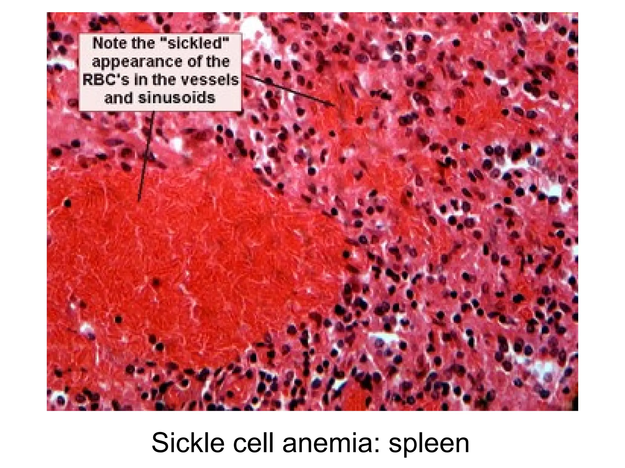 Anemia for medical students12345678.ppt