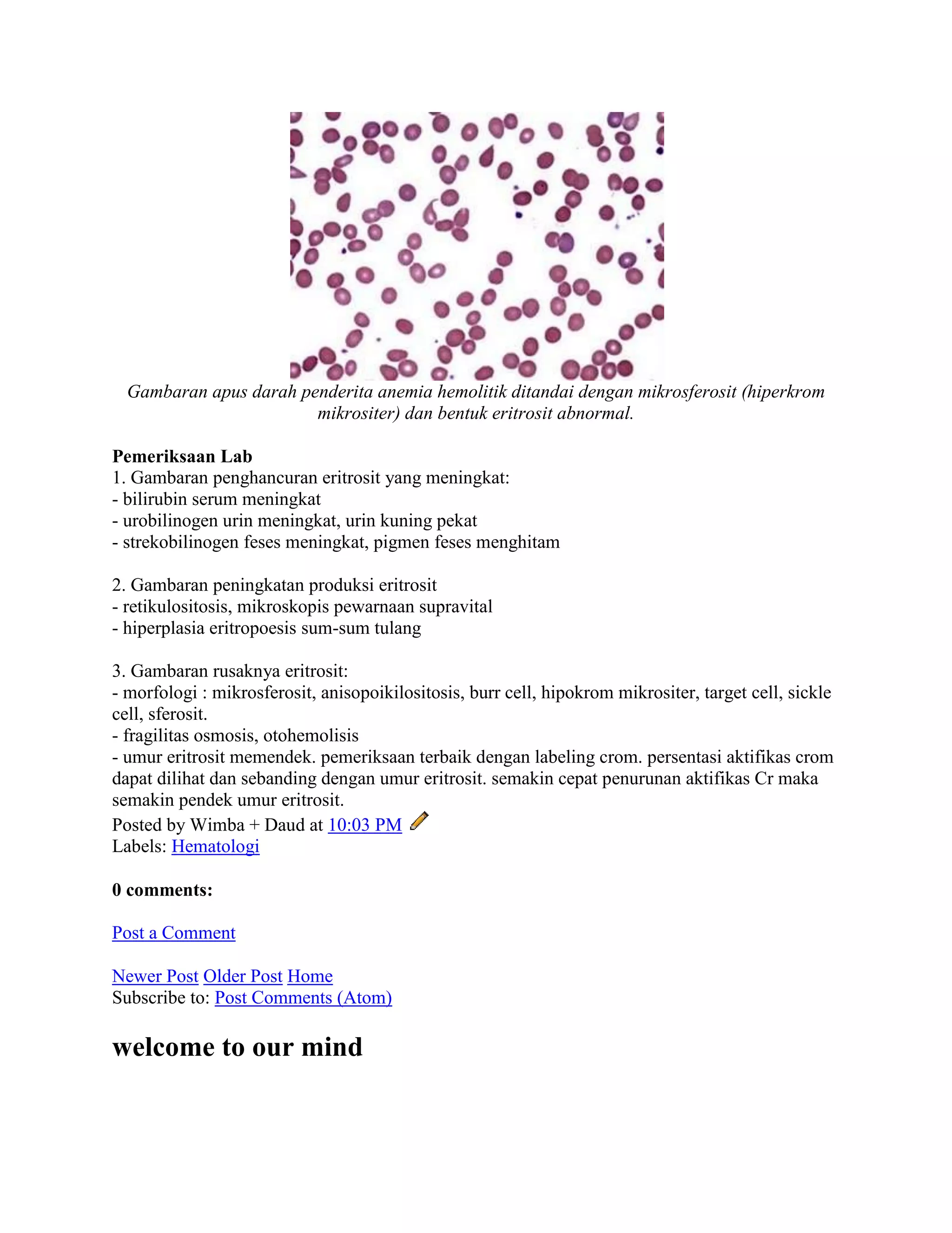 Anemia hemolitik | DOCX