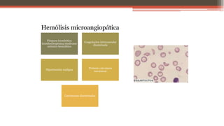 Anemia hemolítica autoinmune y no inmune | PPT