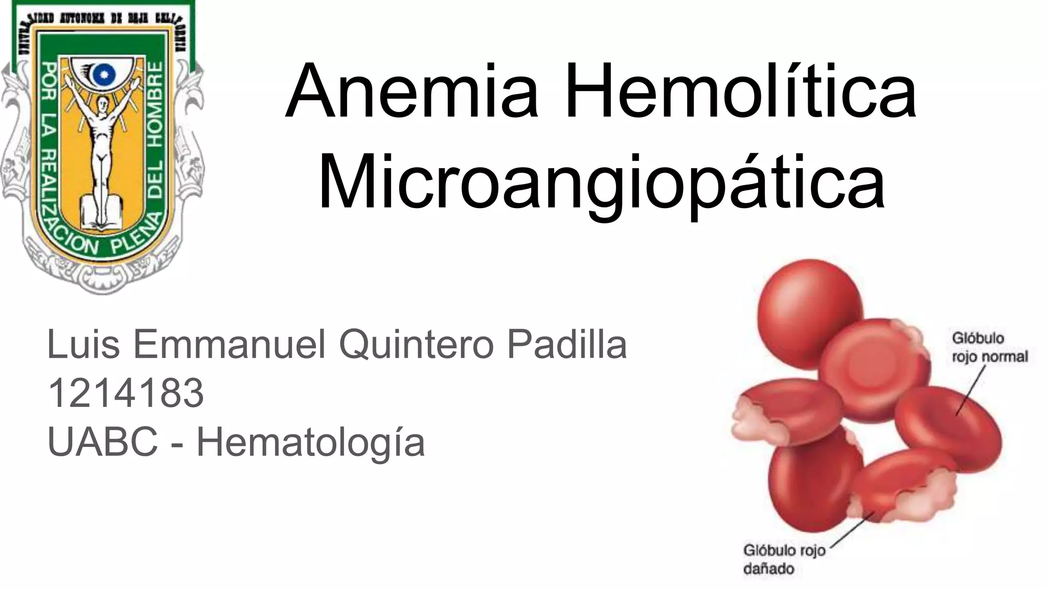 Anemia hemolítica microangiopática | PPTX