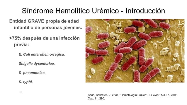 Anemia hemolítica microangiopática | PPTX