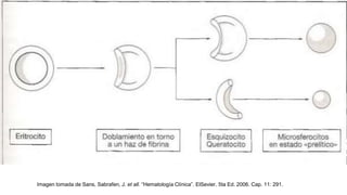 Anemia hemolítica microangiopática | PPTX