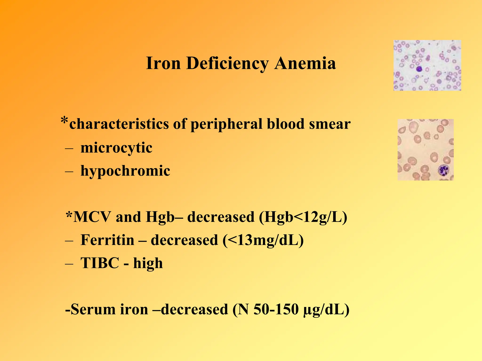 anemia_in_children.ppt a general overview and classification with ...