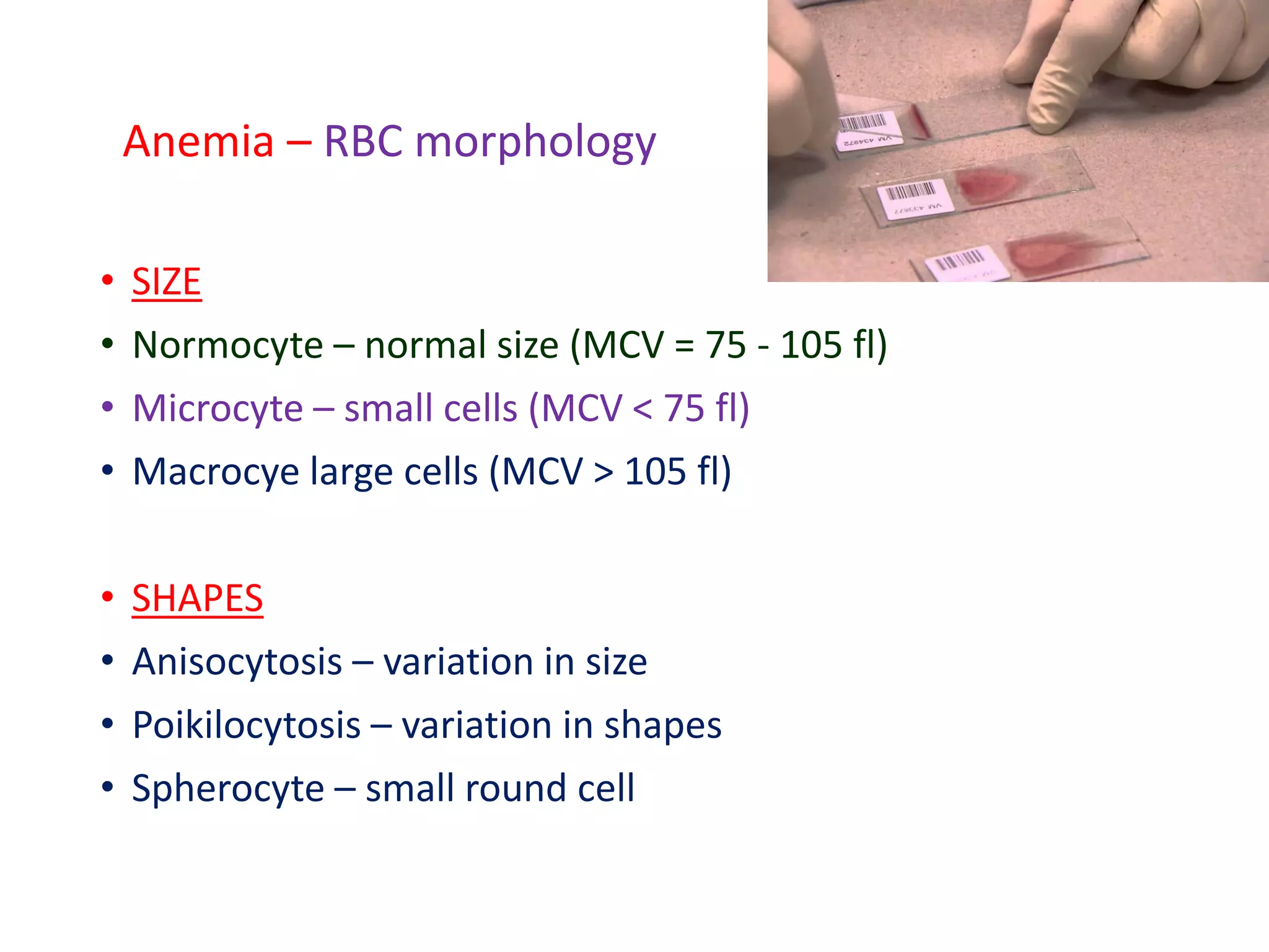 Anemia in children 2021 | PDF