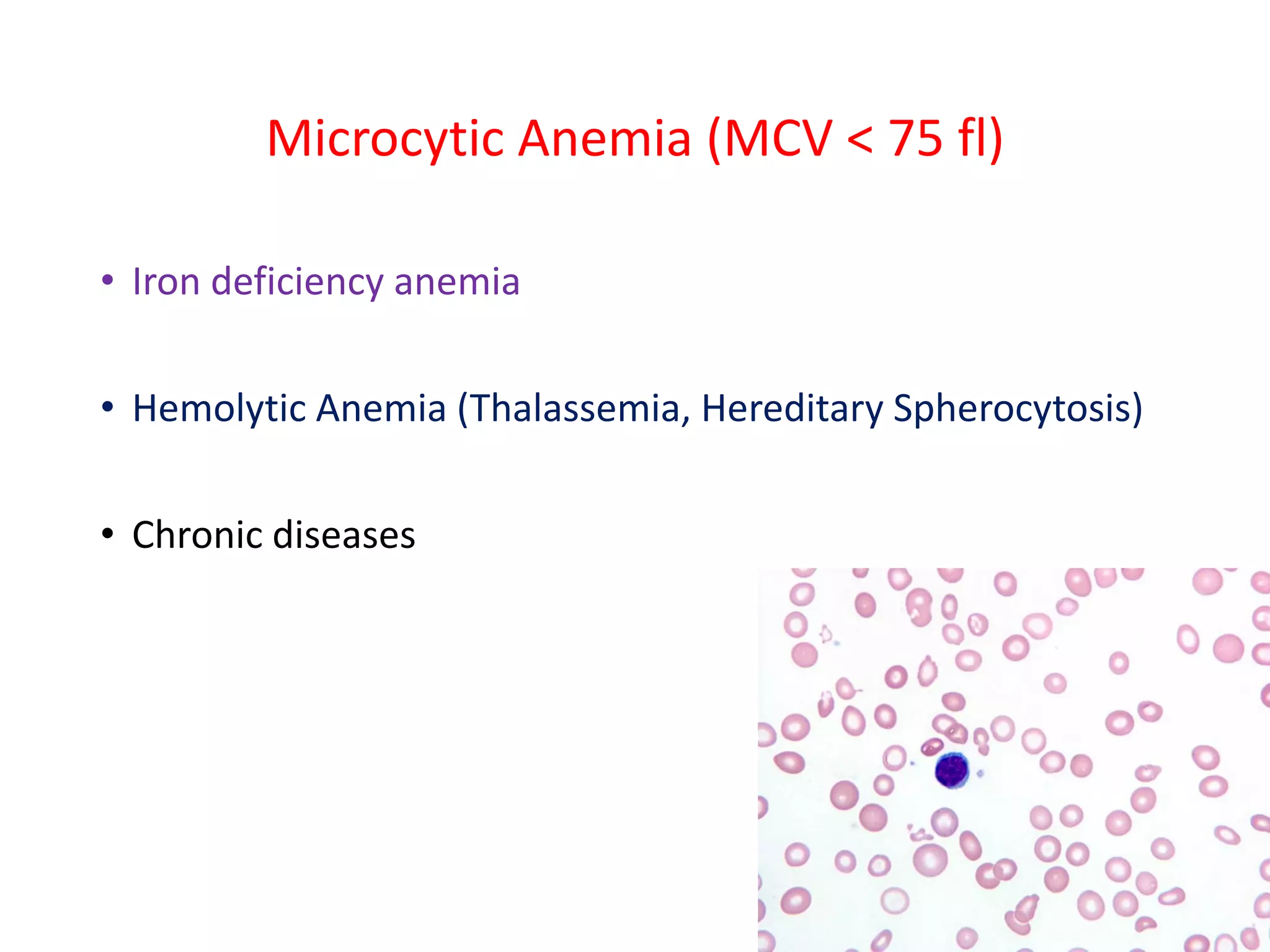 Anemia in children 2021 | PDF