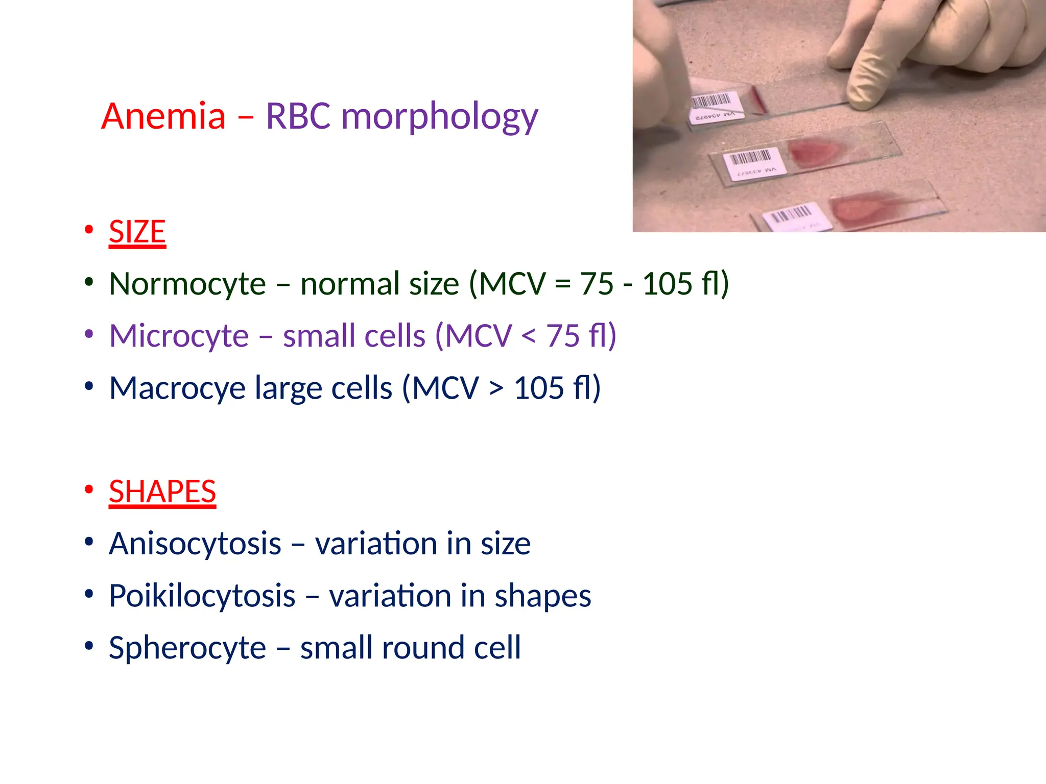 anemia in children ppt presentation paediatrics | PPTX