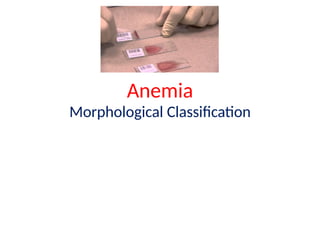 anemia in children ppt presentation paediatrics | PPTX